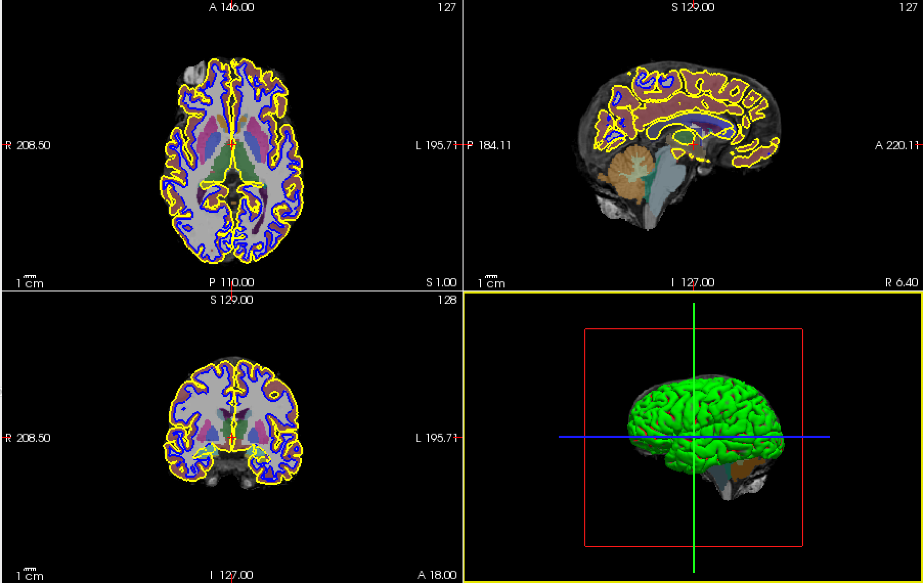 Freeview from FreeSurfer · Bom dia ☀️